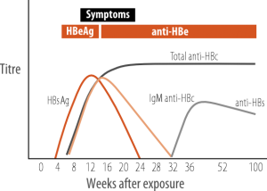 Natural history of hepatitis B virus infection - B Positive